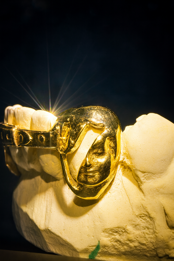 Golden Slit Face Belt Grillz – STL GRILLZZ