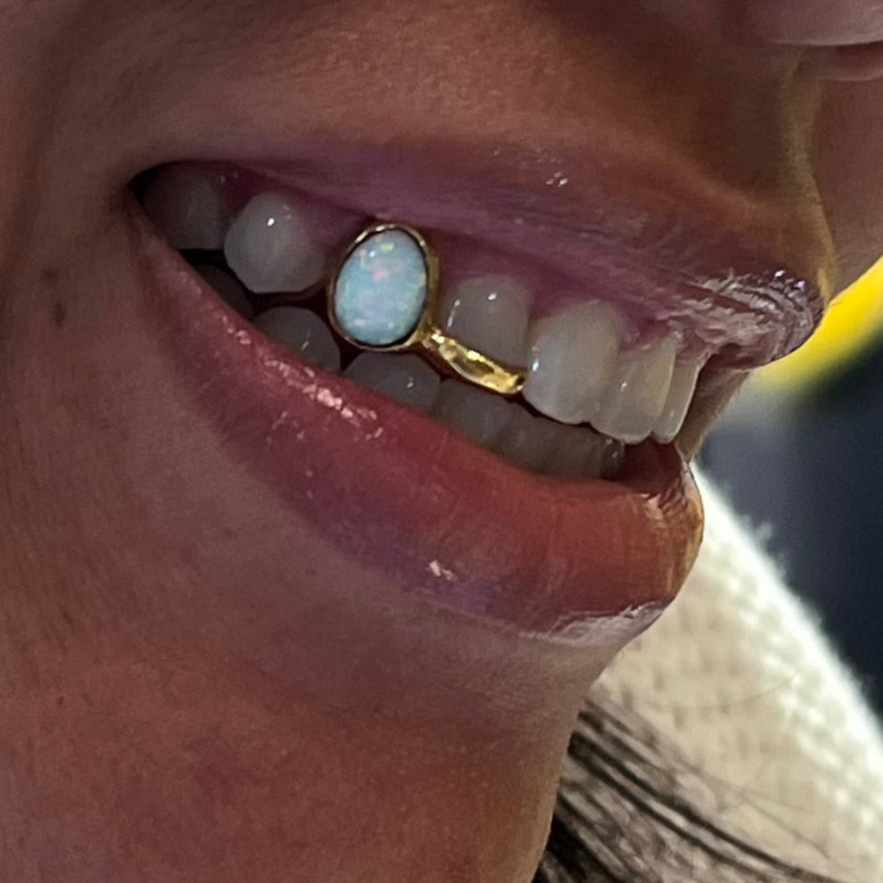 OPAL TEETH 2 PIECE – STL GRILLZZ